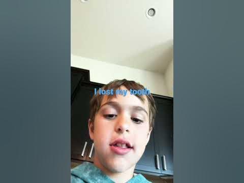 I lost my tooth - YouTube