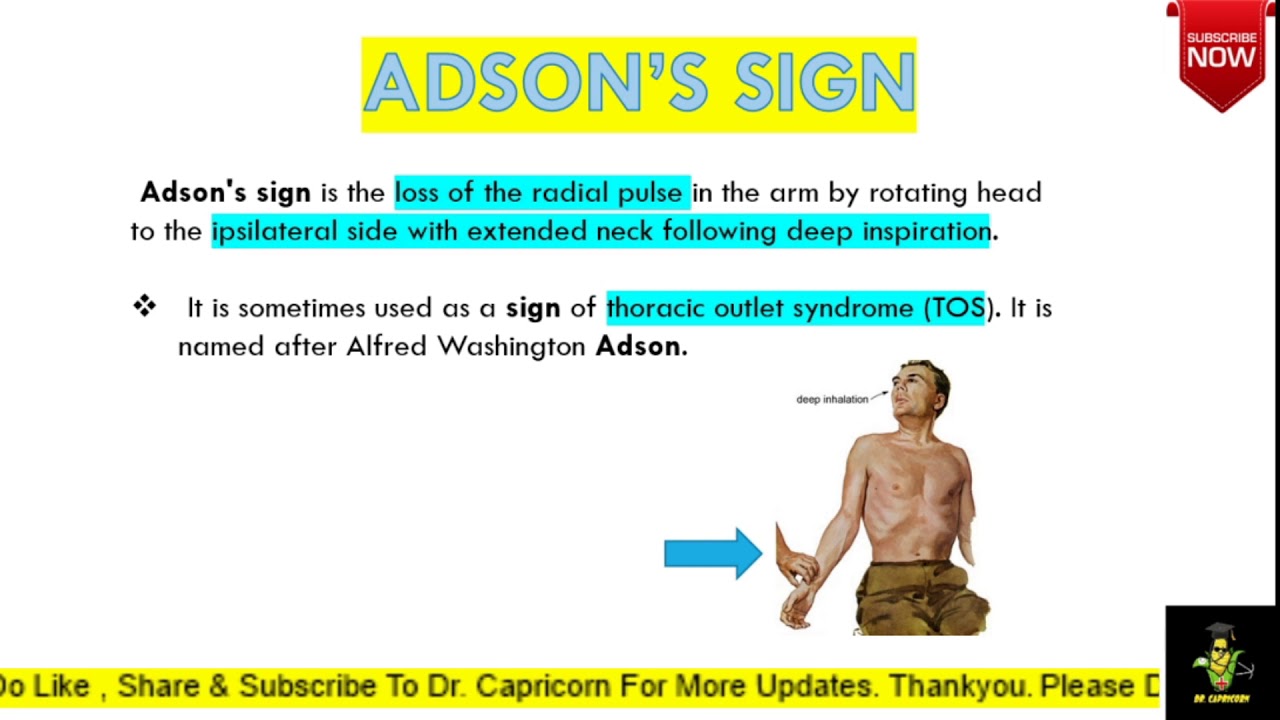 ADSON'S TEST & AUENBRUGGER'S SIGN / NAMED MEDICINE SIGNS/MBBS MADE EASY ...
