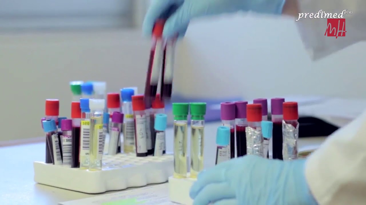 UMH TV - Resultados preliminares del estudio Predimed Plus - YouTube