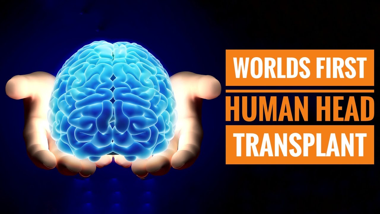 The Worlds First human Head Transplant successful - YouTube
