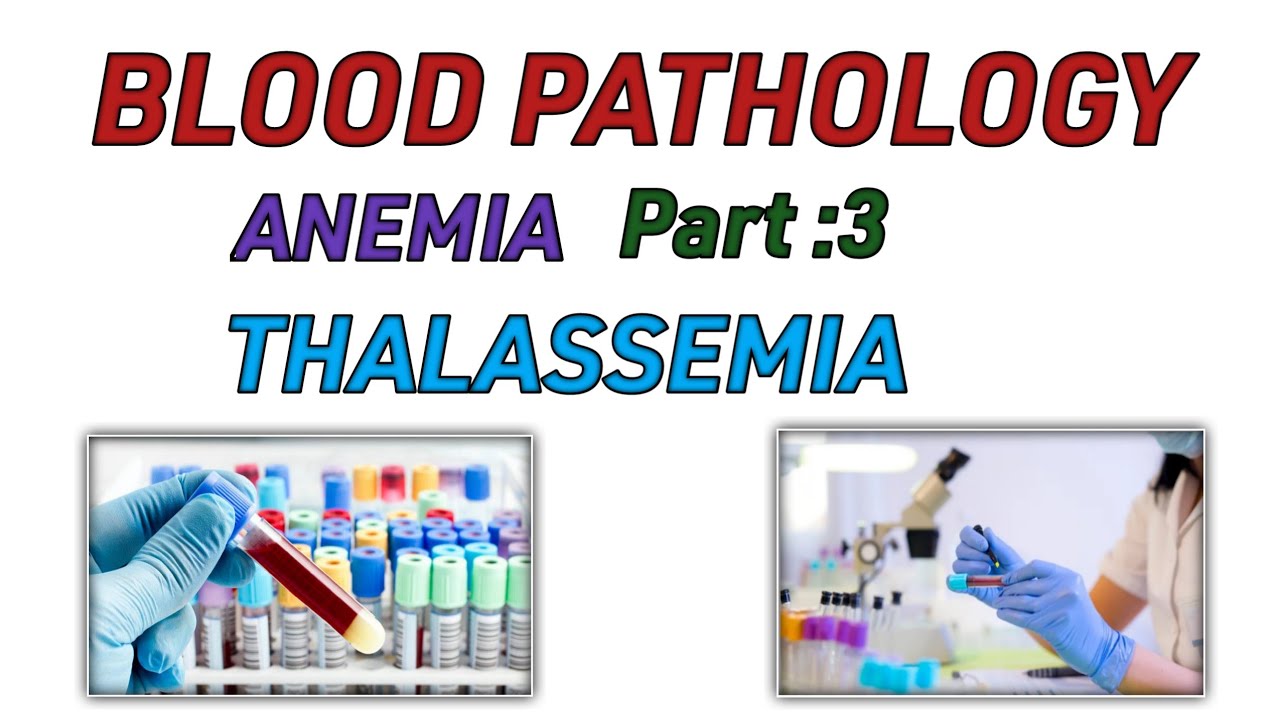 Blood pathology | Thalassemia | Hematology | - YouTube