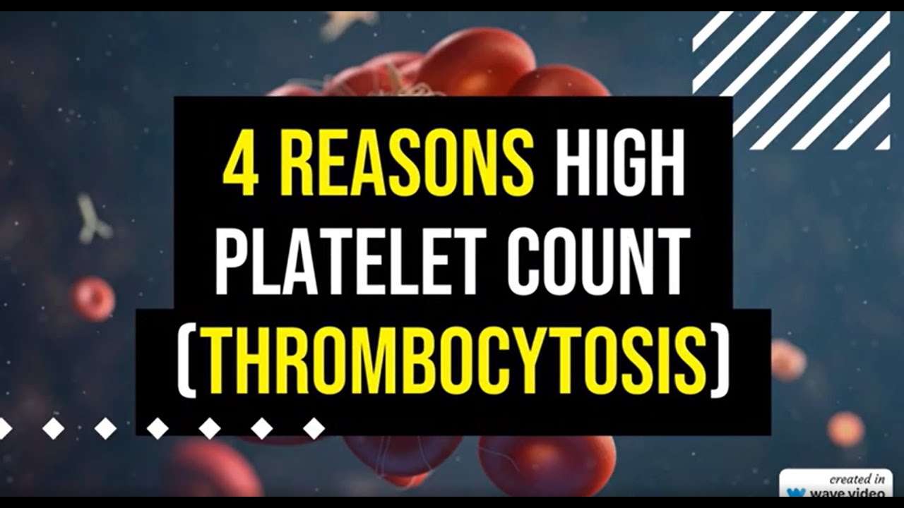4 Reasons High platelet count (thrombocytosis) - YouTube