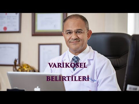 Varikosel şikayetleri, belirtileri nelerdir?