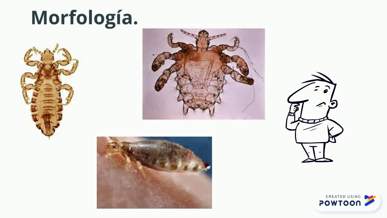 ANOPLUROS PEDICULOS: CAPITIS, CORPORIS, Y PUBIS - YouTube