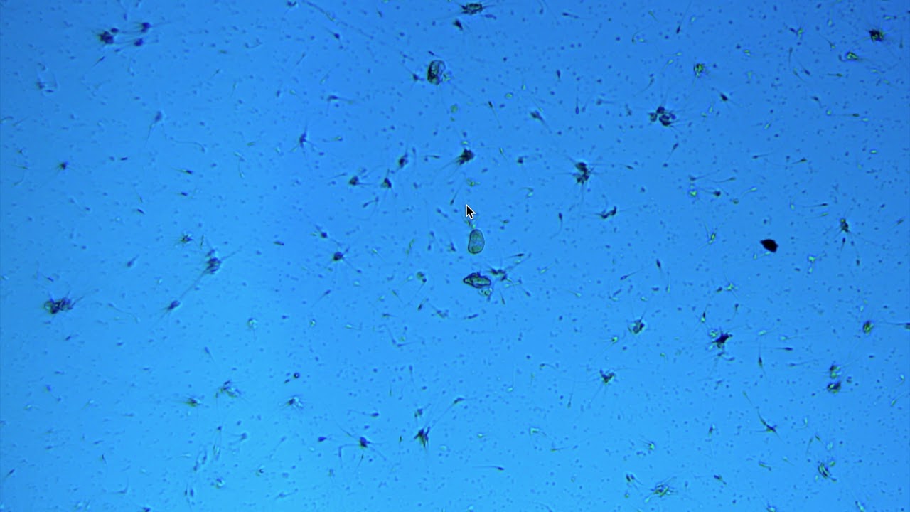 Poodle Sperm Semen Under 100x Magnification For AussieDoodles YouTube poodle-sperm-semen-under-100x-magnification-for-aussiedoodles-youtube