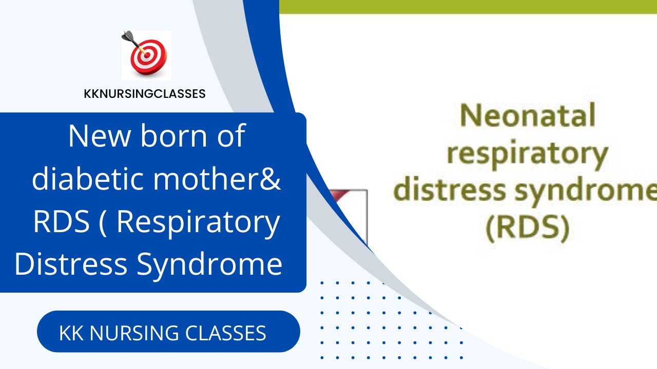 Newborn of Diabetic mother and RDS ( Respiratory distress syndrome ...