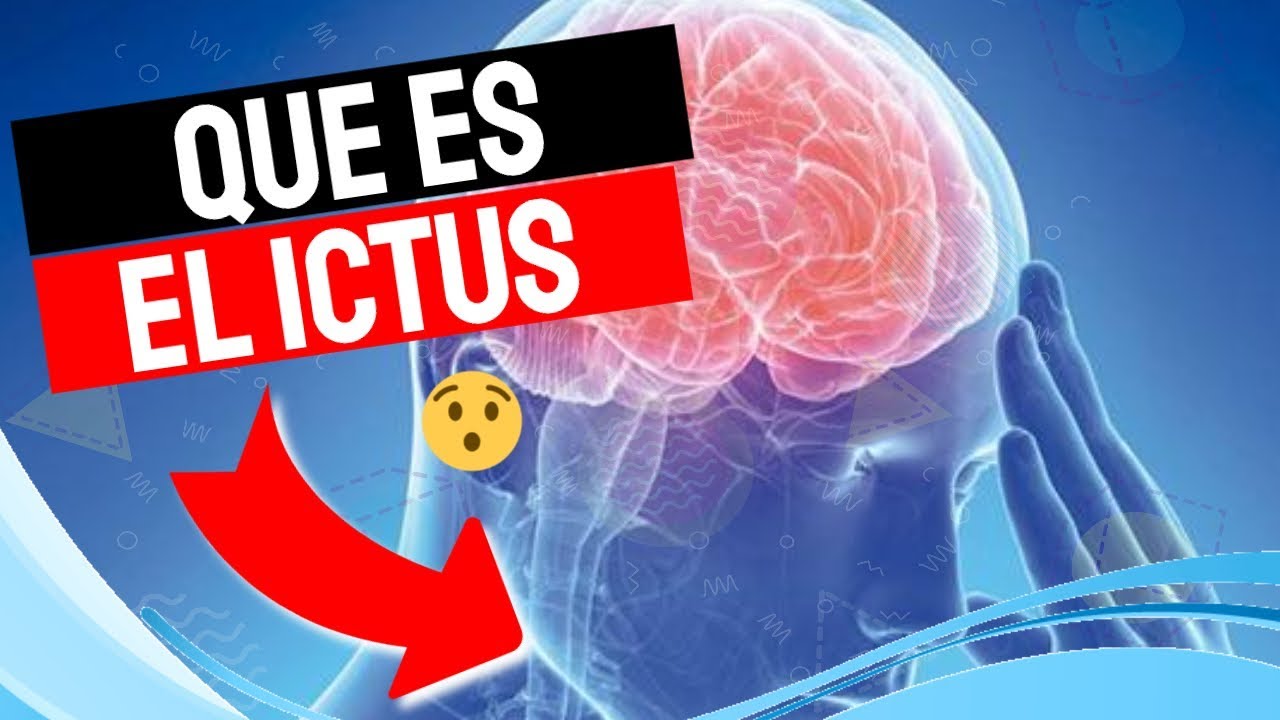 Que Es El Ictus ? - YouTube