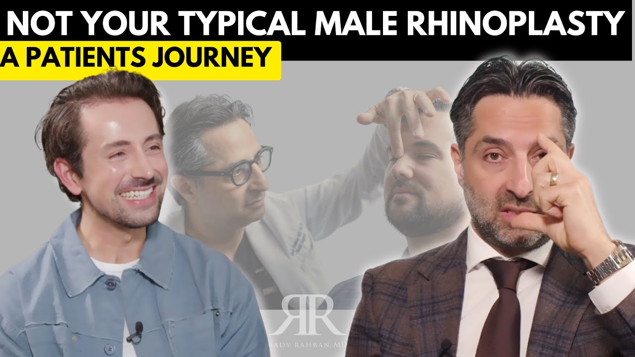 I Got a Nose Job (Rhinoplasty) - My Unexpected Recovery Journey - YouTube