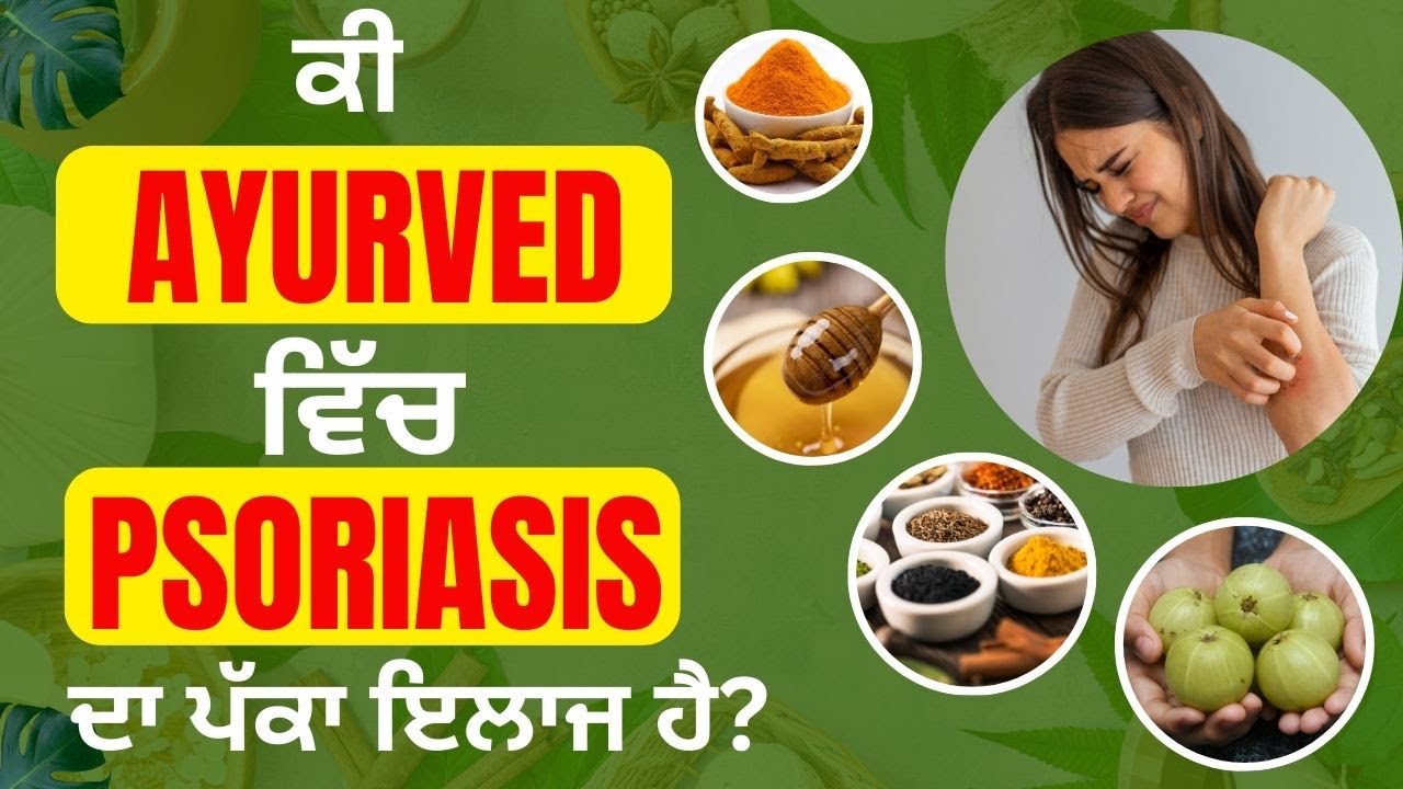 Psoriasis Permanent Ayurvedic Treatment? ਜਾਣੋ ਆਯੁਰਵੇਦਿਕ ਹੱਲ! | ਡਾ ...