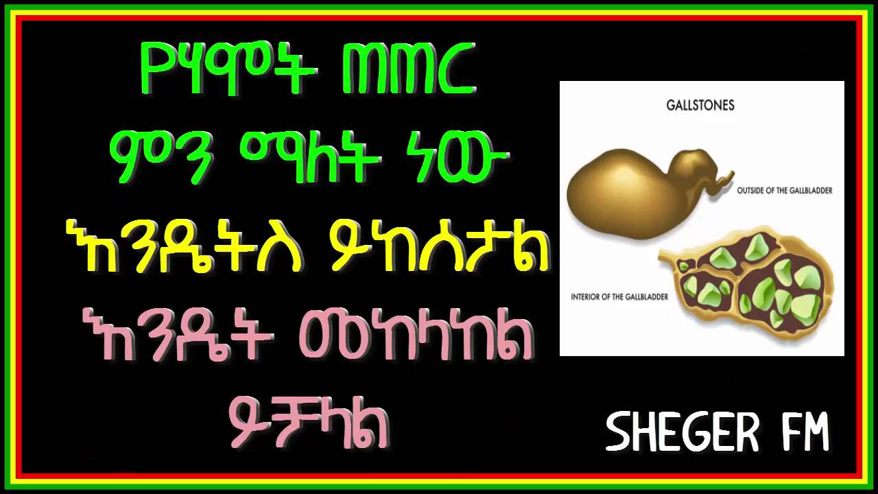 የሃሞት ጠጠር ምን ማለት ነው፣ እንዴትስ ይከሰታል ፣እንዴት መከላከል ይቻላል Sheger Fm - YouTube