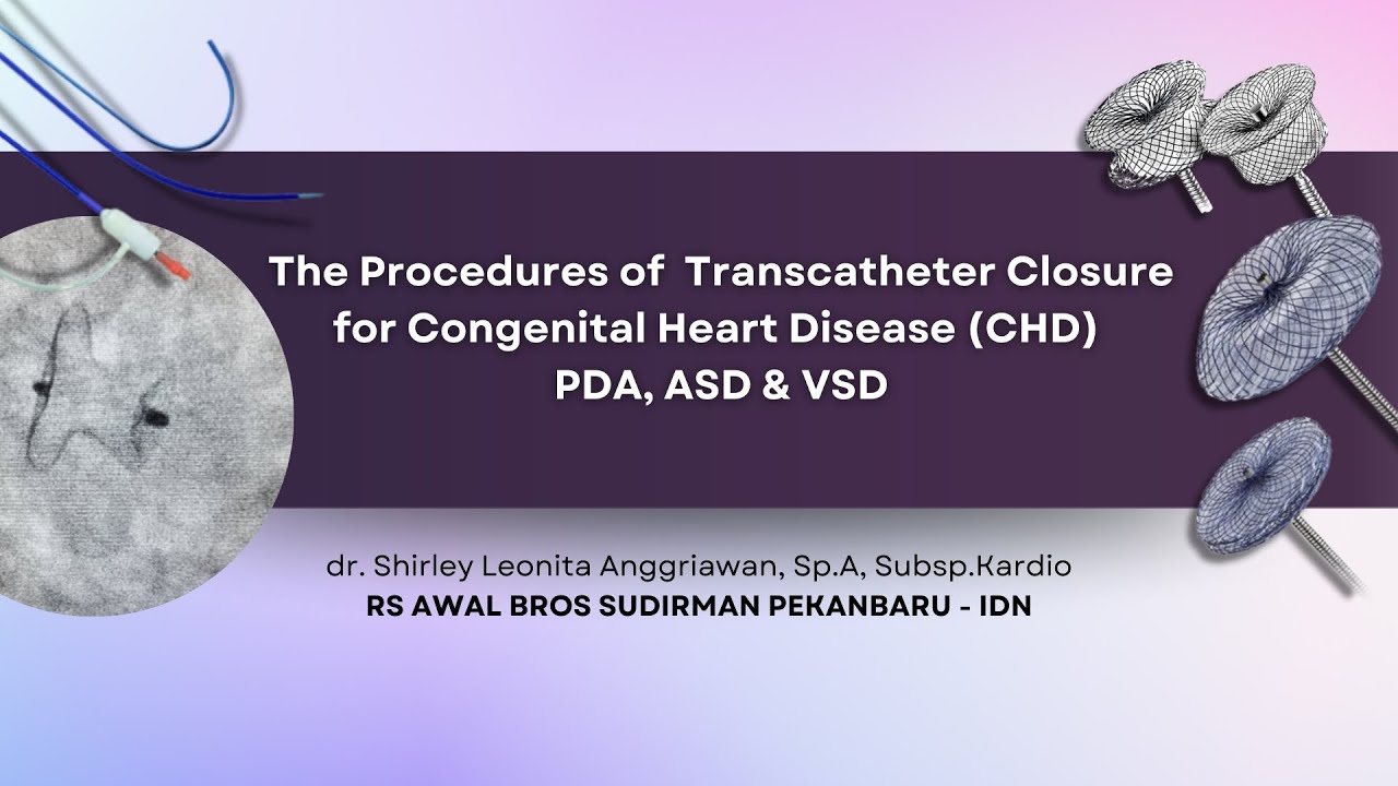 Understanding Interventional Therapy & Percutaneous Closure for CHD ...
