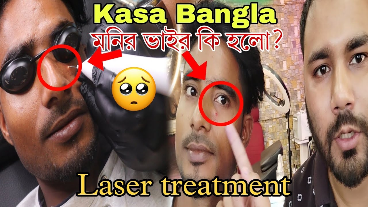Lesser Treatment | Silchar Lesser facial treatment - YouTube