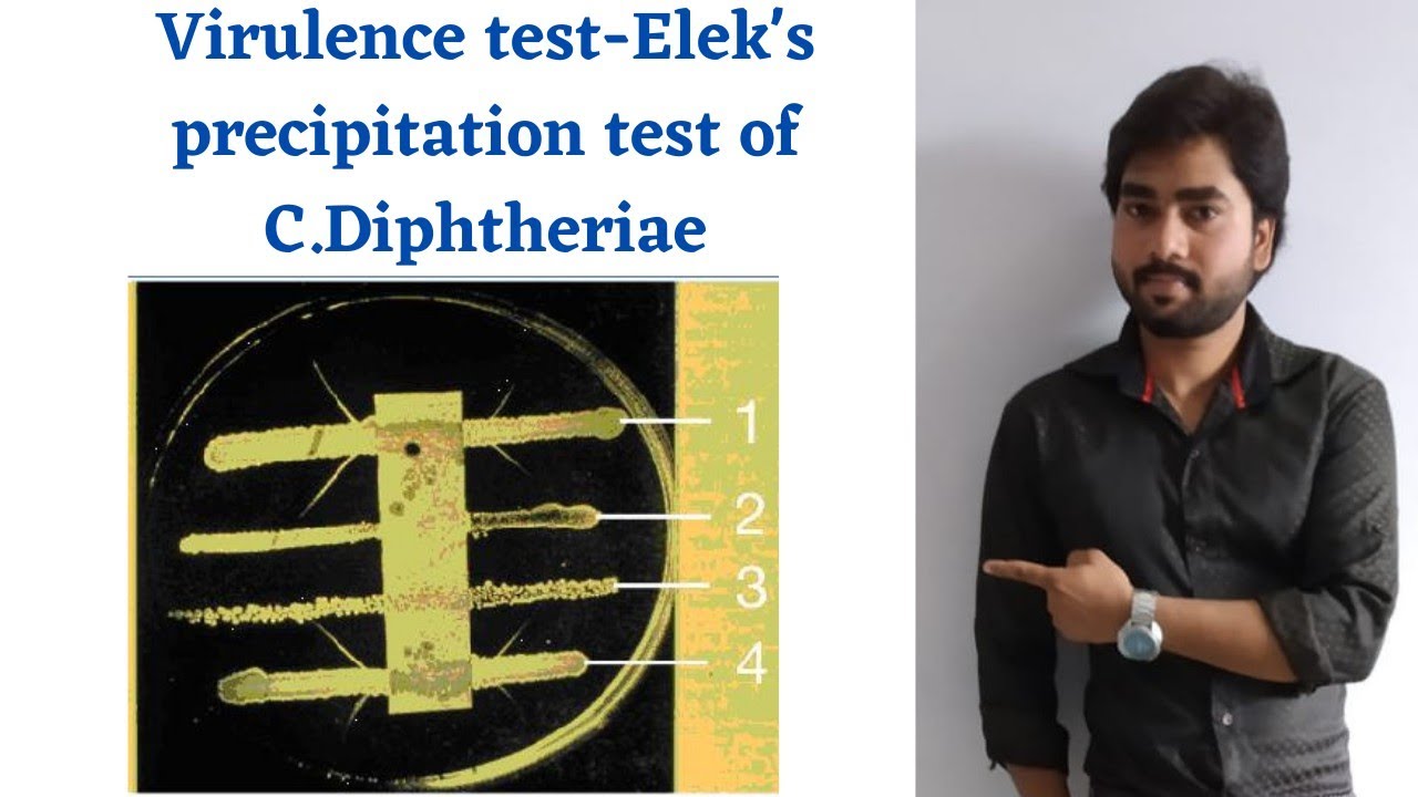 C. Diphtheriae | Elek's precipitation test |Tissue culture etc.. (By ...