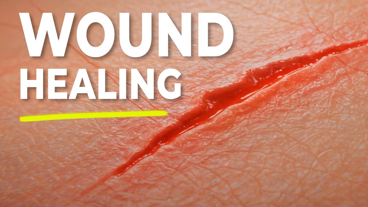 How Your Body Heals Wounds & Cuts | 3D Animation - YouTube