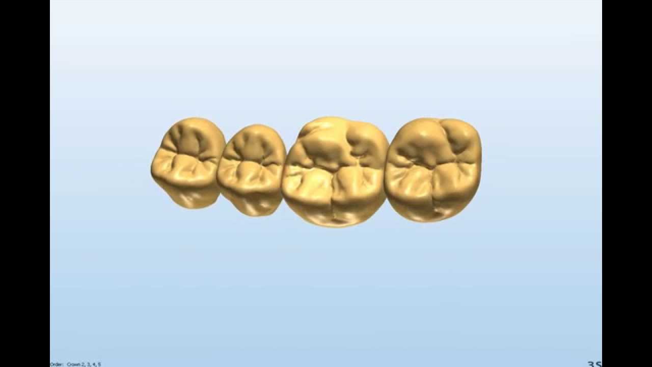 Kastle Mills 3Shape Custom Tooth Library - Exclusively at Kastle Mills ...