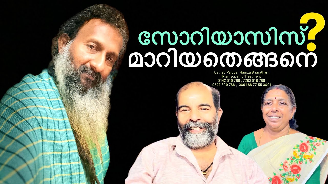 സോറിയാസിസ് മാറിയതെങ്ങനെ Usthad Vaidyar Hamza BharathamPlantsopathy ...