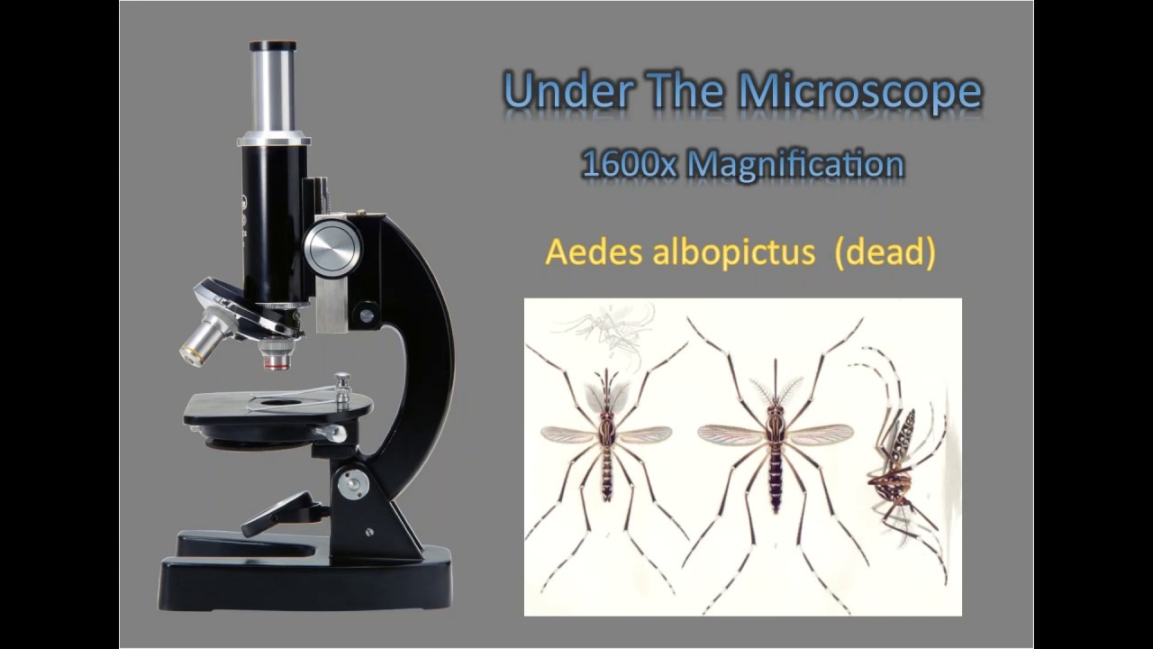 Under The Microscope - Dead Mosquito (Aedes albopictus) - YouTube