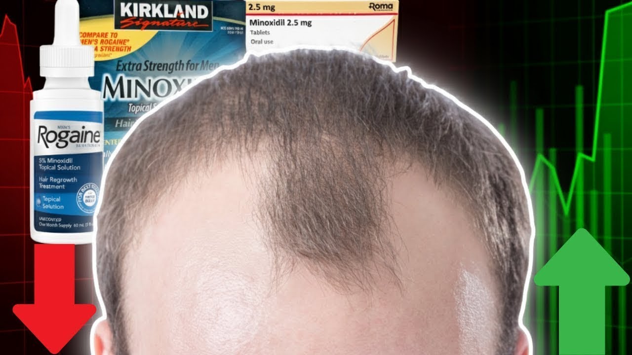MORE Shedding on Hair Loss Treatment? Why The "Dread Shed" Is A GOOD ...