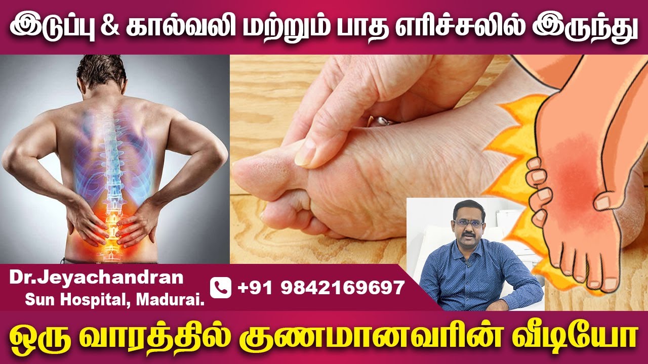L4-L5 DISC BULGE SCIATICA பாத எரிச்சல் FOOT BURNING | சியாட்டிகா ...
