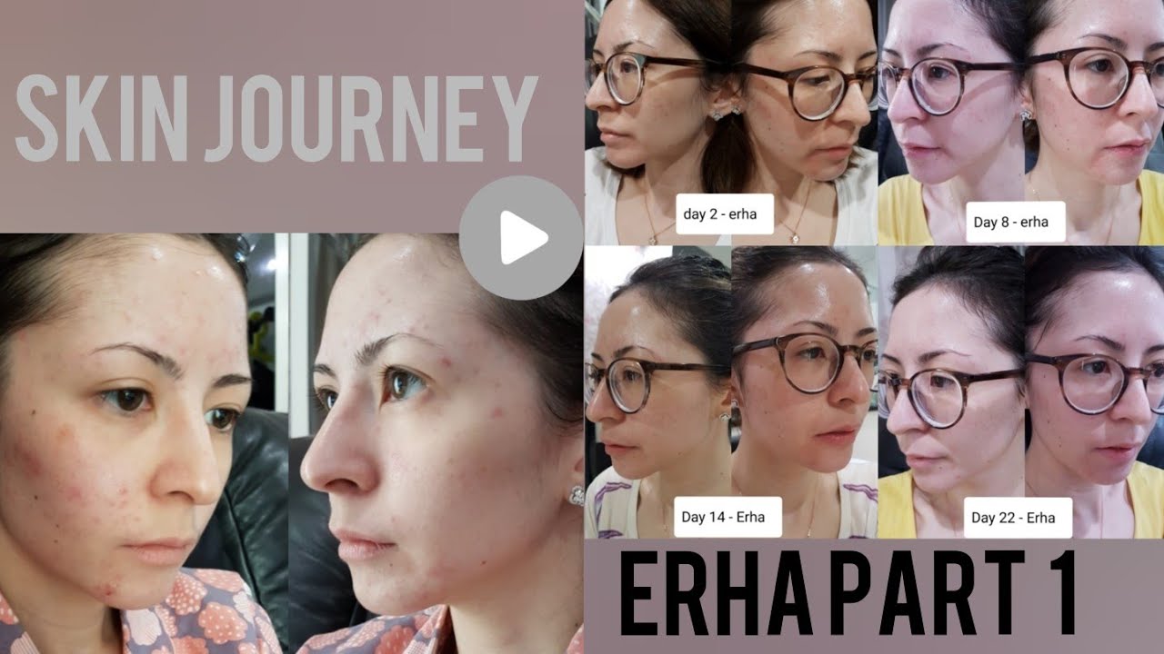 ERHA REVIEW PART 1 - YouTube