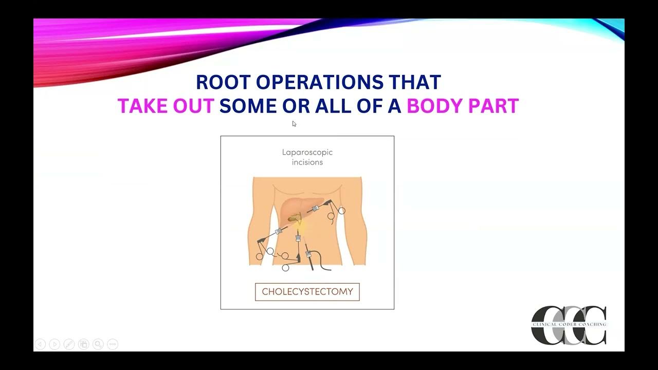 ICD-10-PCS Root Operation Overview Part 1 - YouTube