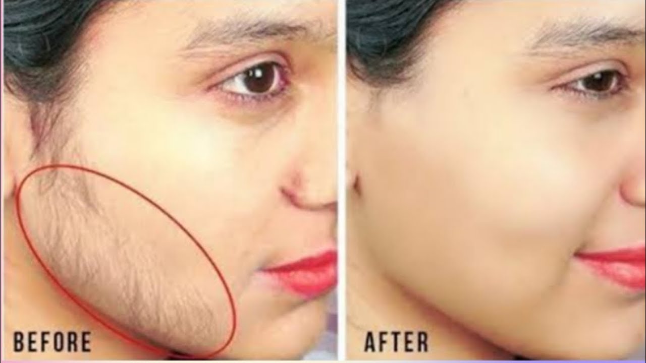how to make permanently hair remover at home | DIY hair remover cream ...