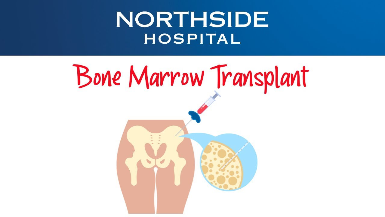 What You Need to Know About Bone Marrow Transplants - YouTube