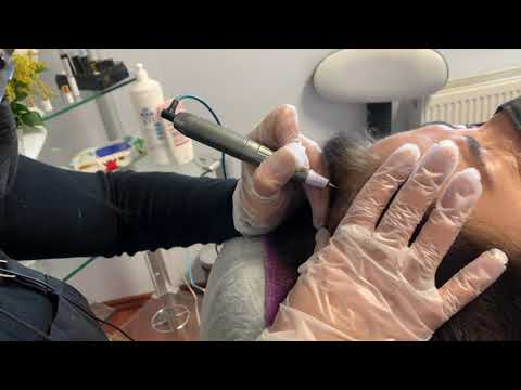 Saç Simülasyonu Nasıl Yapılır? - Ata Estetik Beauty & Wellness / Evrim Çetinkaya