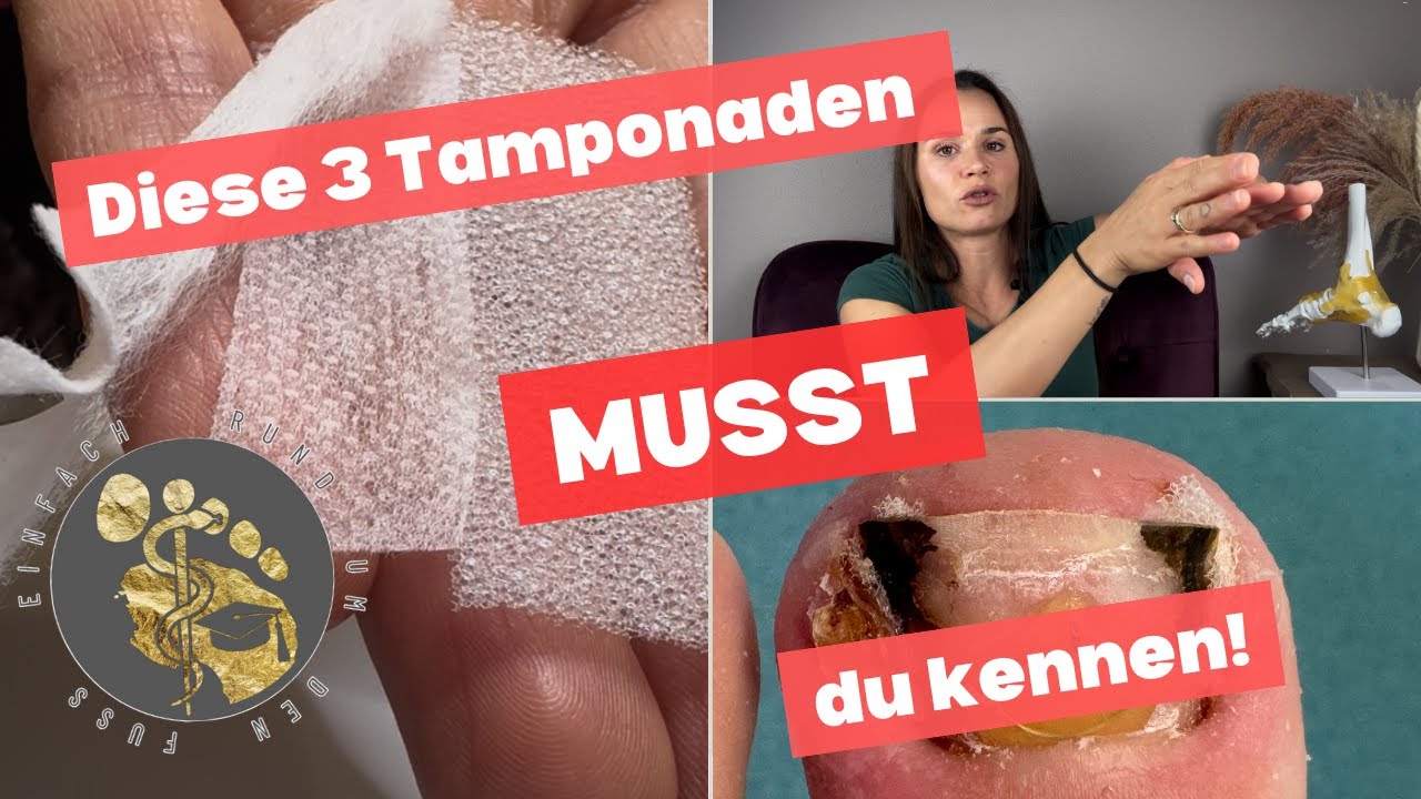 🩹 Drei WICHTIGE Tamponaden-Typen in der Fußpflege 👣 | Anwendung & Tipps ...