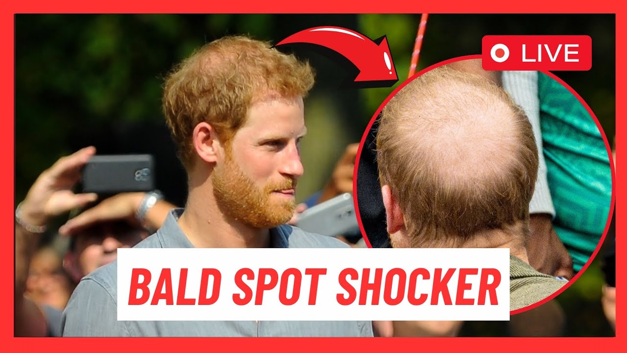 Prince Harry’s Shocking Bald Spot Caught on Camera at Invictus Finale ...