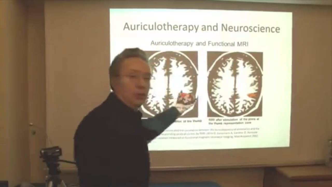 Auricoloterapia - Prof. David Alimi - YouTube