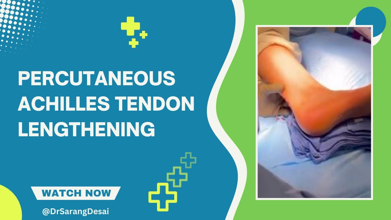 Percutaneous Achilles Tendon Lengthening - YouTube