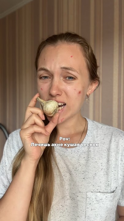 Стоп АКНЕ с сывороткой , арт 142054898 #уход#акне#уходоваякосметика# ...
