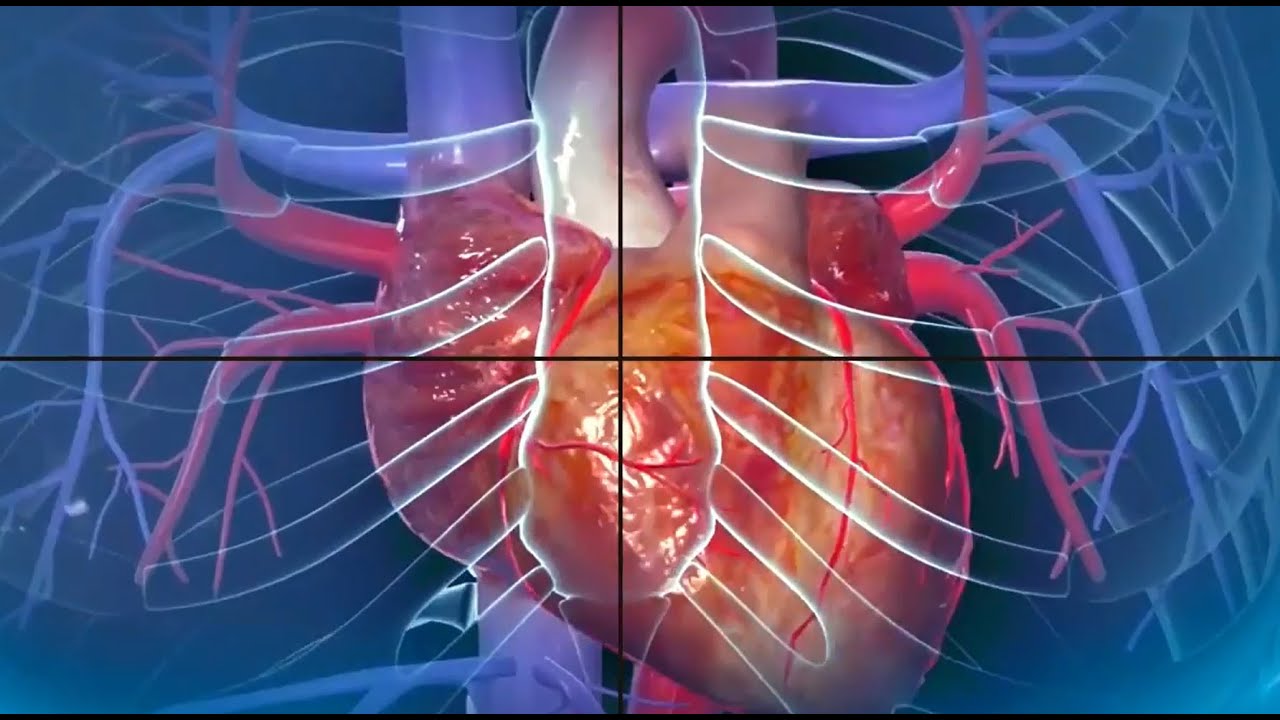 Professional Cardiovascular Interventions HD - YouTube
