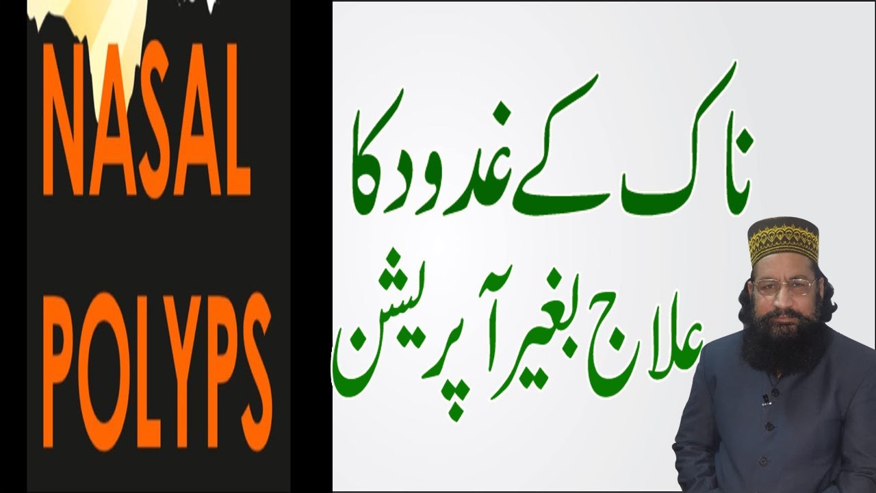 Naak Ki Gadood Ka Ilaj Nasal Polyp Treatment By Dr Ghulam Dastgeer ...