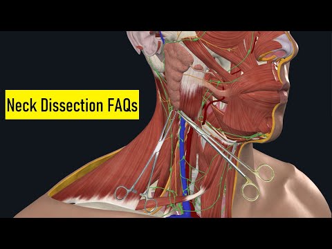 Neck Dissection Surgical Anatomy: OR FAQs & Answers [201] Didactic