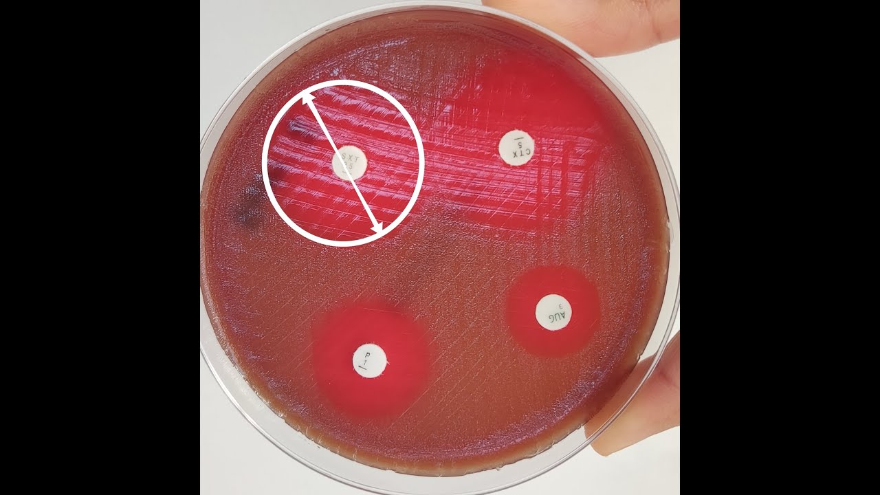 Antibiogramme - YouTube