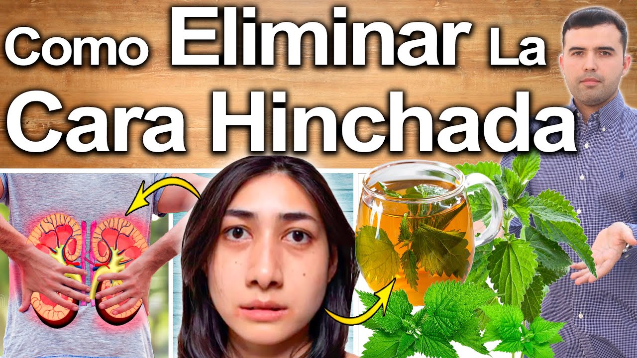ELIMINA TU CARA HINCHADA - Causas, Enfermedades Y Soluciones Avanzadas ...