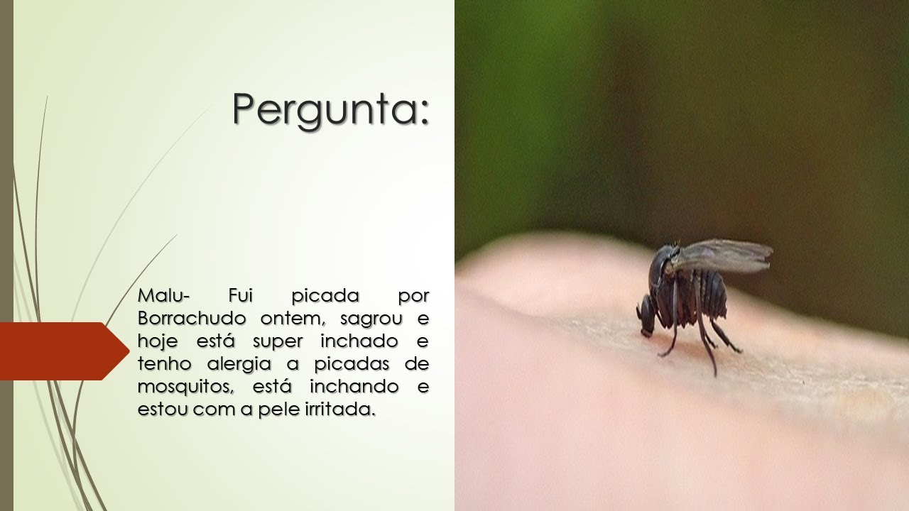 Fui picada por Borrachudo, está muito inchado | Tenho alergia a picada ...