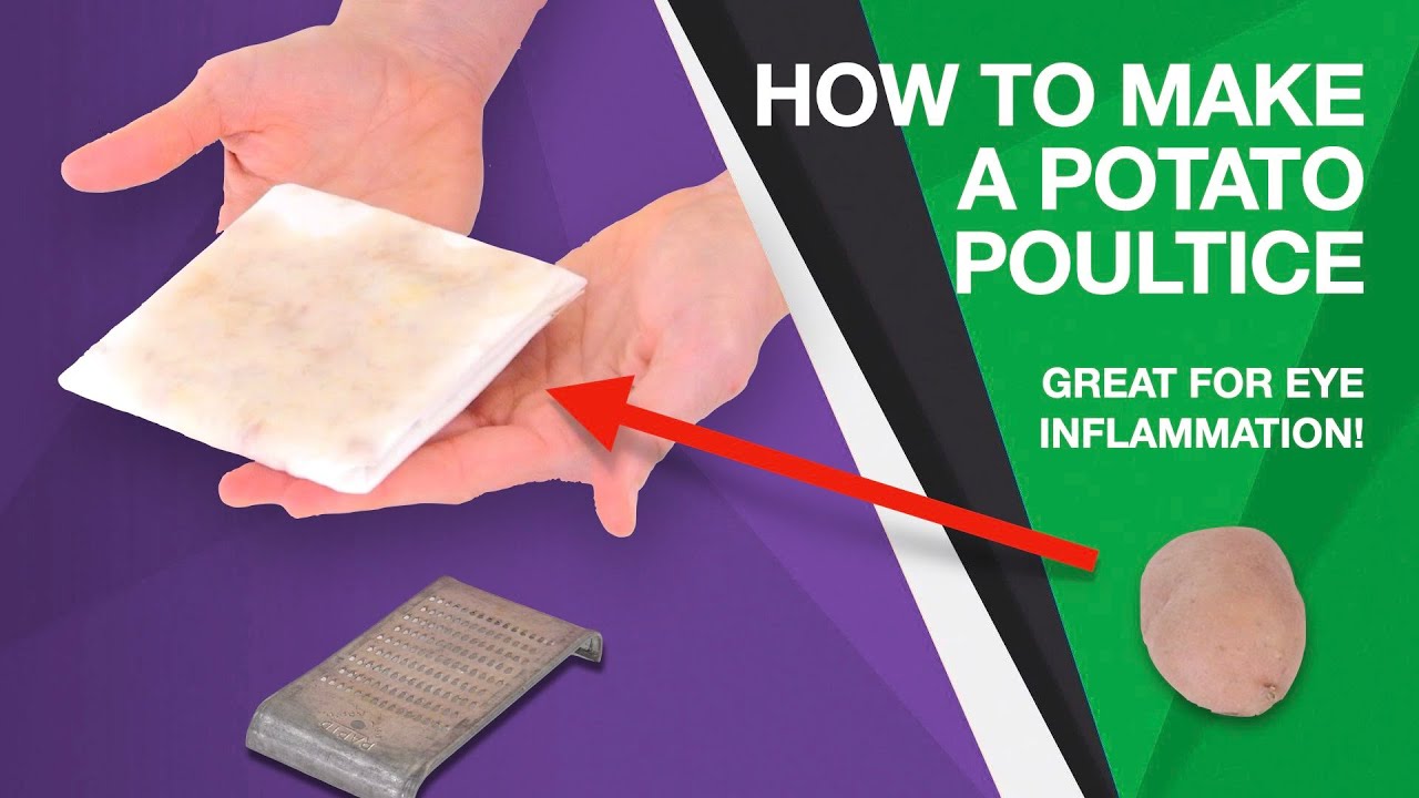 How to Make a Potato Poultice - YouTube
