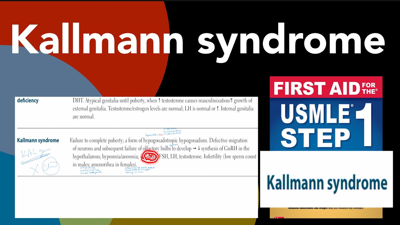 Kallmann syndrome- Hyposmia/anosmia due to olfactory bulb dysgenesis in ...