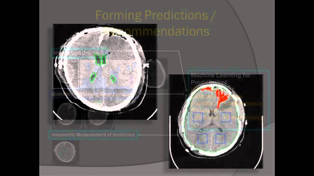 Biomedical image and signal processing lab, Dr Najarian, VCU. - YouTube