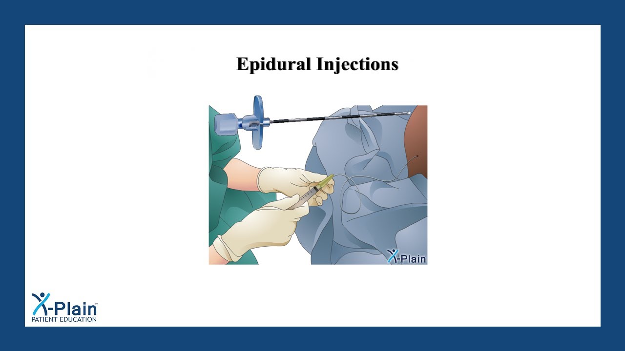 Epidural Injections - YouTube