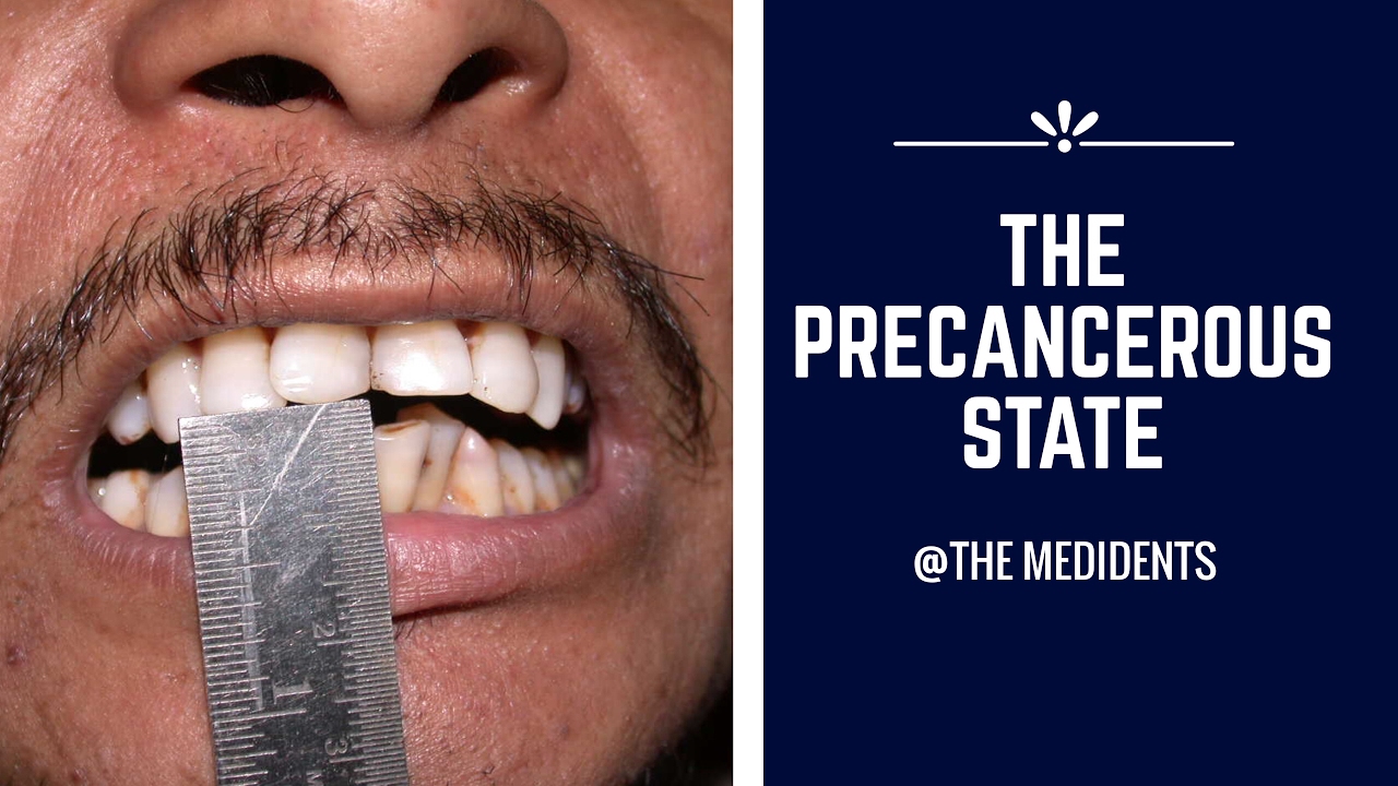 The Precancerous State - YouTube