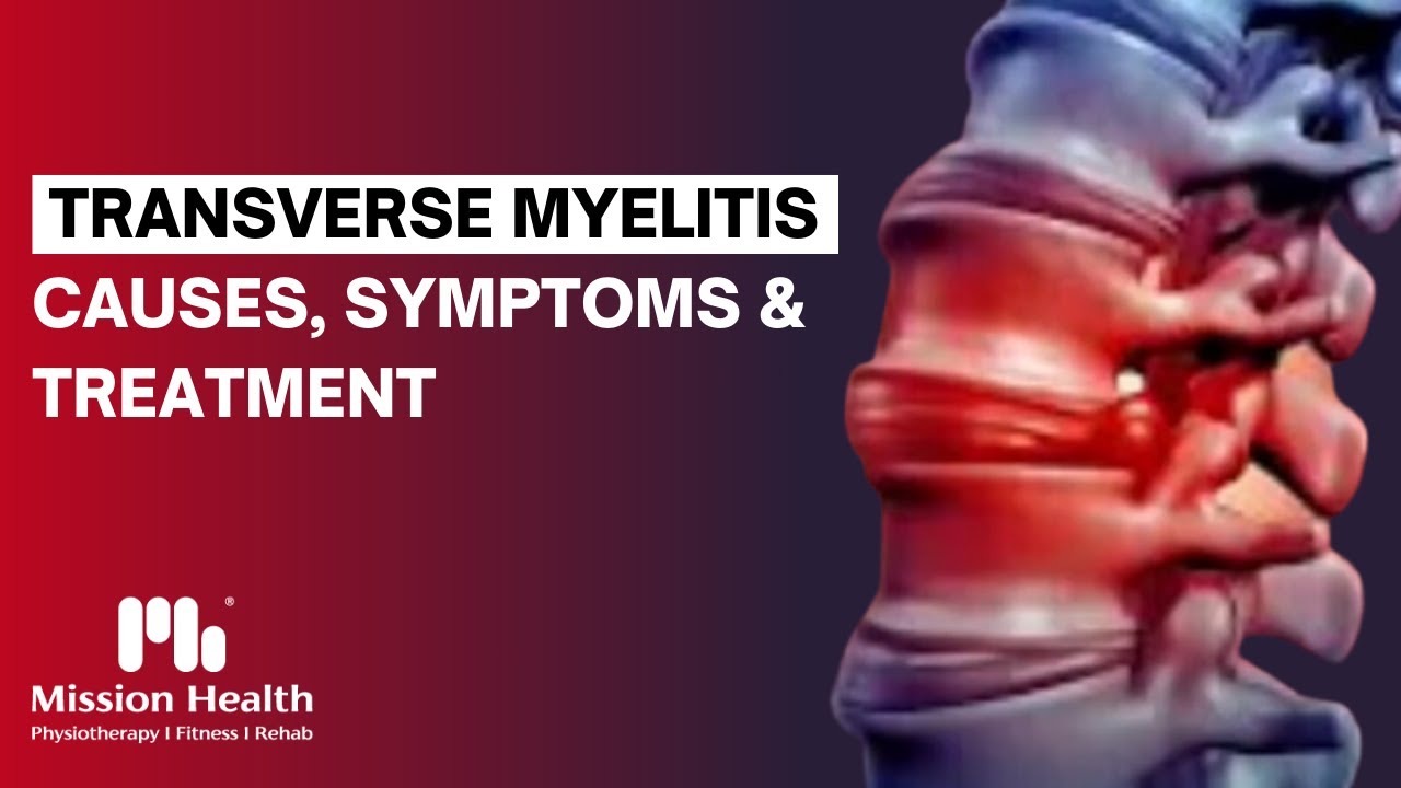 How to Treat Transverse Myelitis? | Causes & Symptoms | Advanced Neuro ...