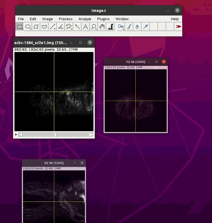How to use ImageJ for PET image - YouTube