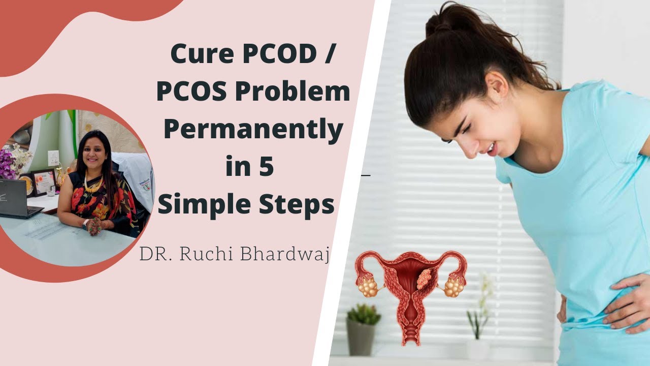 Cure PCOD / PCOS Problem Permanently in 6 Simple Steps | Dr. Ruchi ...