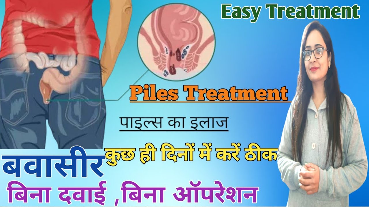 बवासीर (Piles) को करें जड़ से खत्म।😳इस आसान से इलाज द्वारा!Piles ...