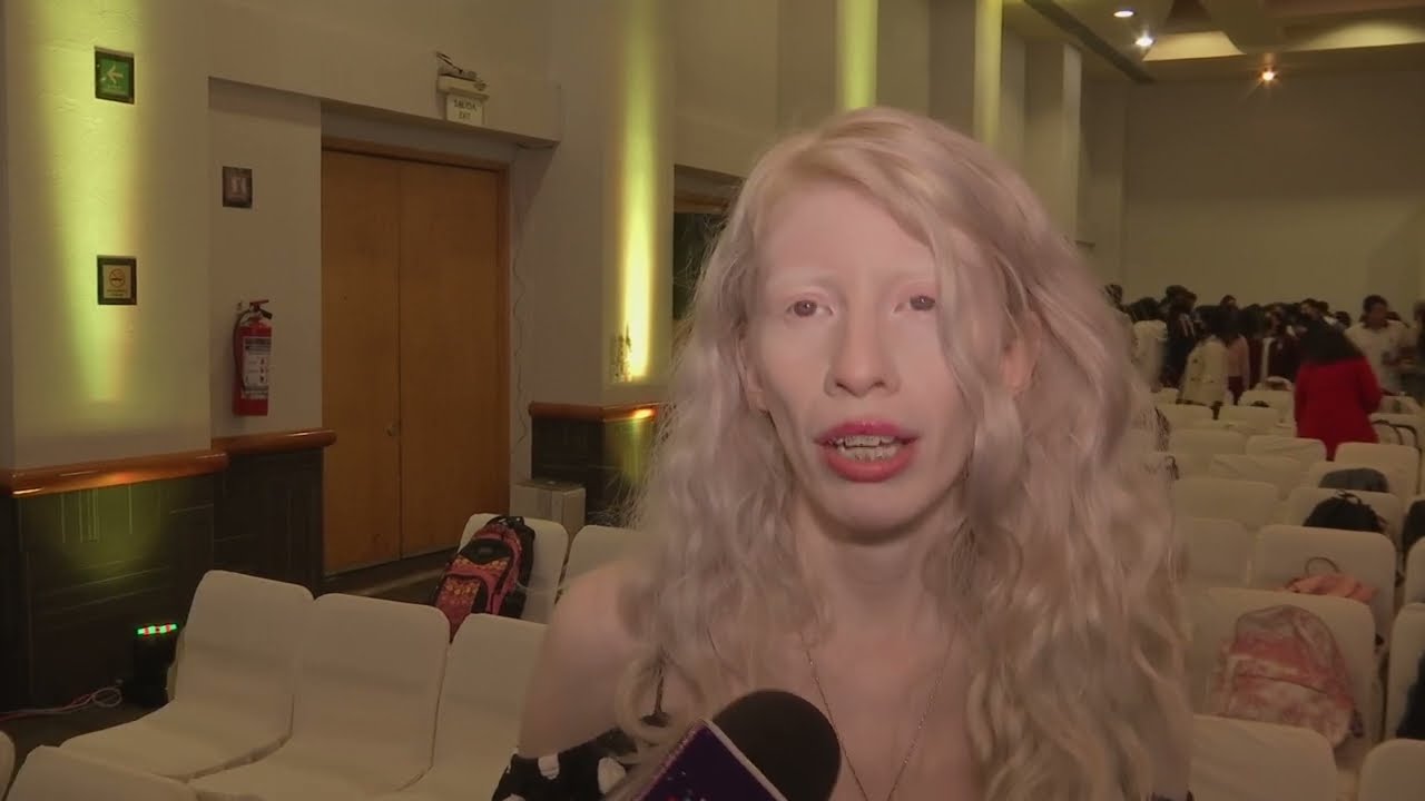Movimiento Albino Latino lucha por el respeto a las personas albinas en ...