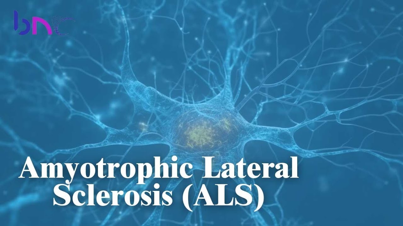 What is Amyotrophic Lateral Sclerosis (ALS) | (ALS) Causes & Treatment ...
